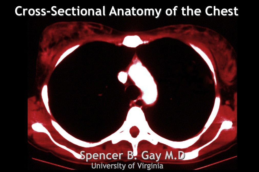 Cross Sectional Anatomy Thorax