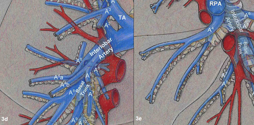 CT Pulmonary Angiography