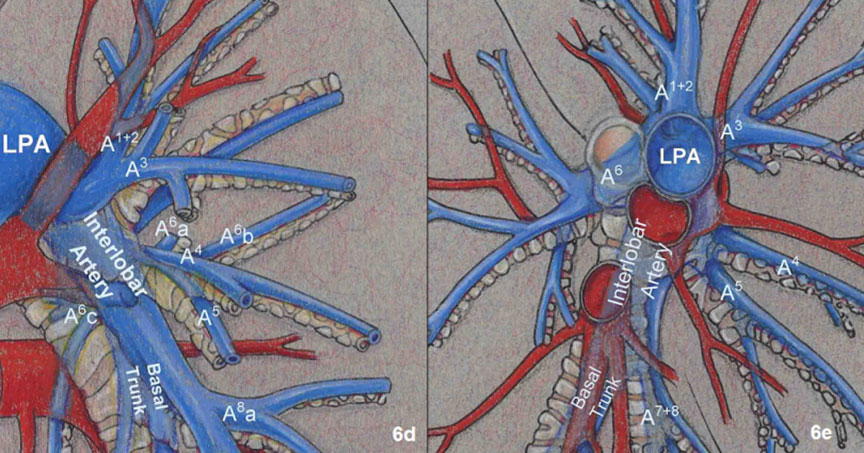 CT Pulmonary Angiography