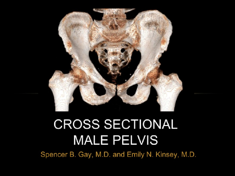 Cross Sectional Male Pelvis
