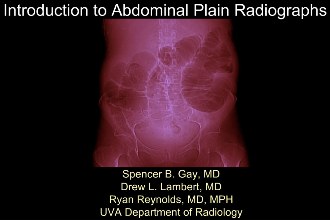 Introduction of Abdominal Plain Radiographs