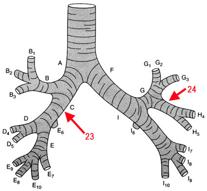 Chest Radiology