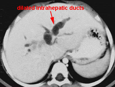 Gastrointestinal Radiology