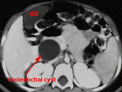 Gastrointestinal Radiology