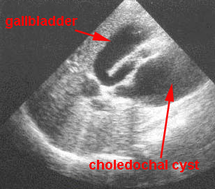 Gastrointestinal Radiology
