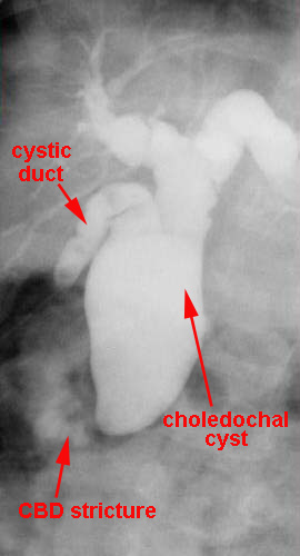 Gastrointestinal Radiology