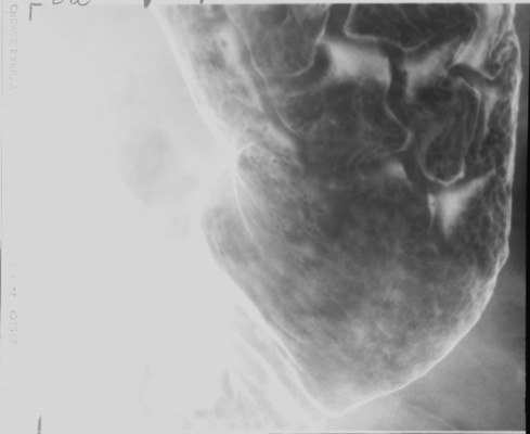 Gastrointestinal Radiology