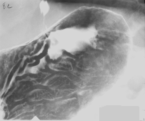 Gastrointestinal Radiology