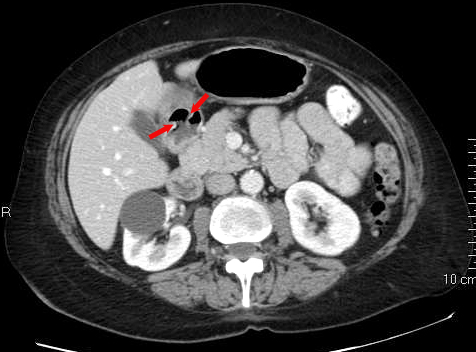 Gastrointestinal Radiology