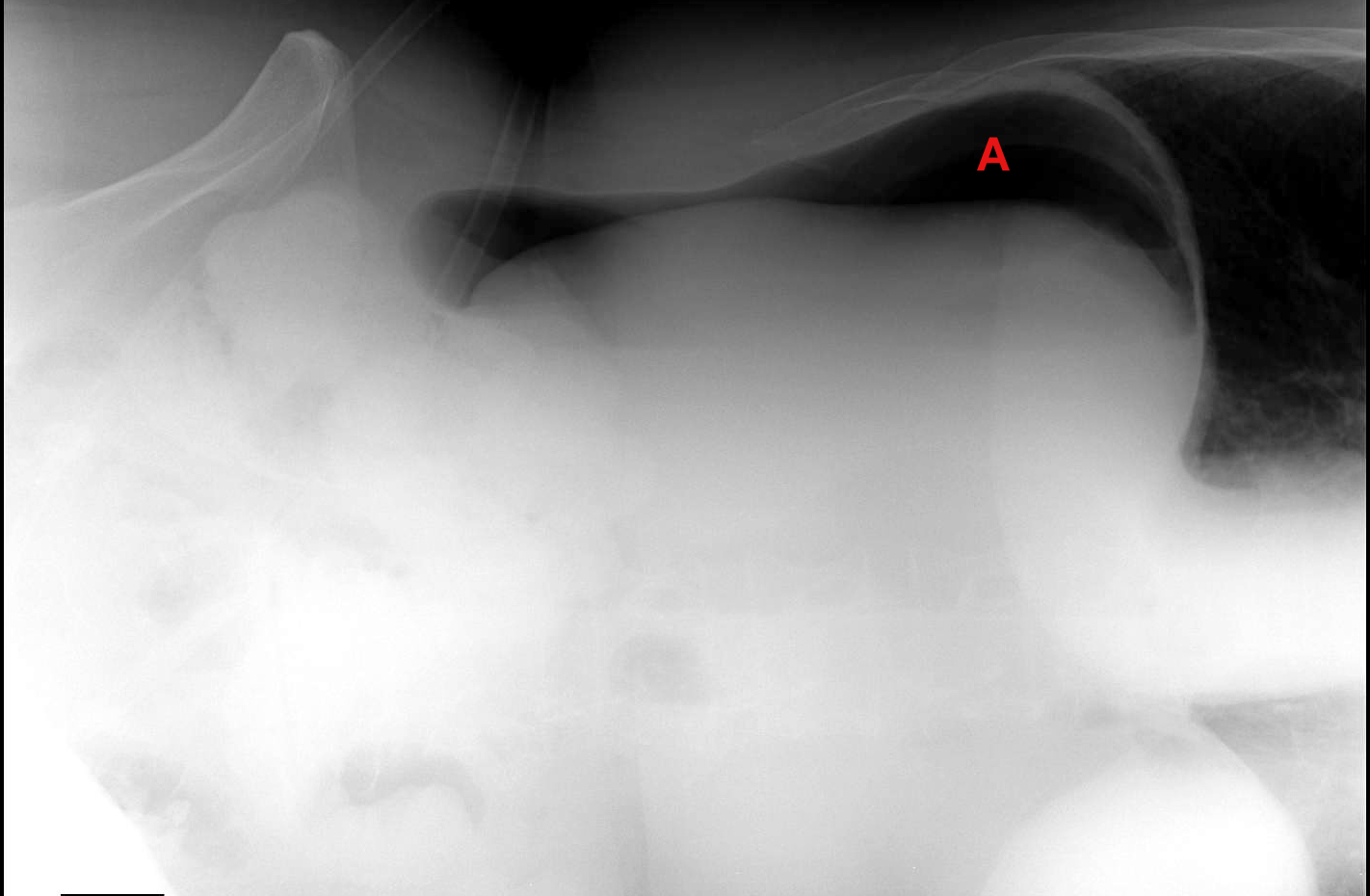 Gastrointestinal Radiology
