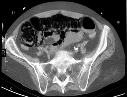 Gastrointestinal Radiology