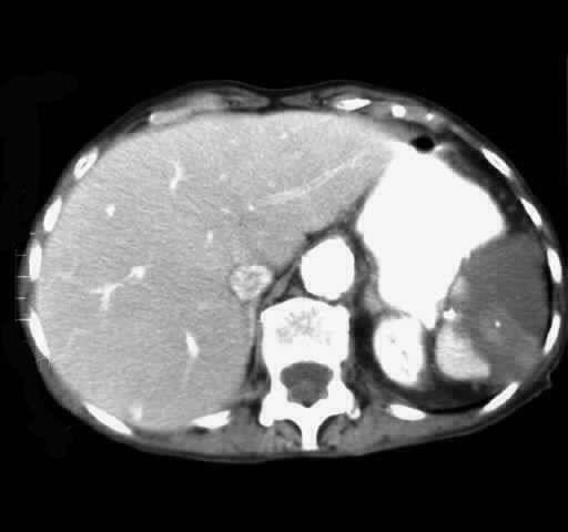 Gastrointestinal Radiology