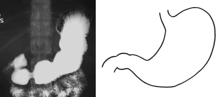 Gastrointestinal Radiology