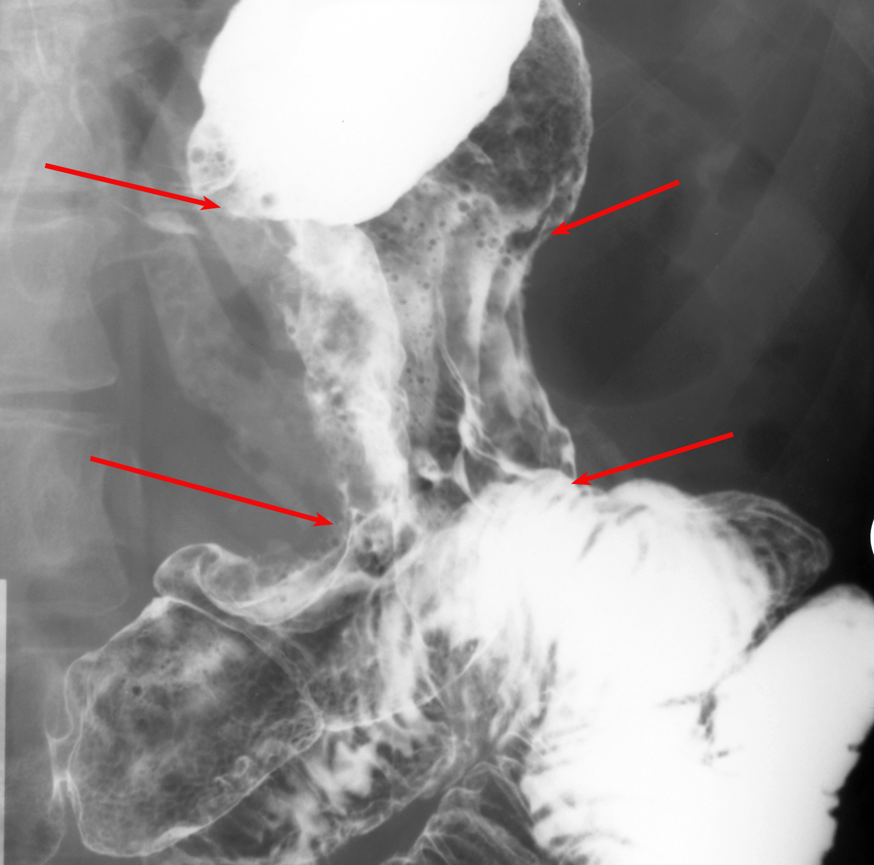 Gastrointestinal Radiology