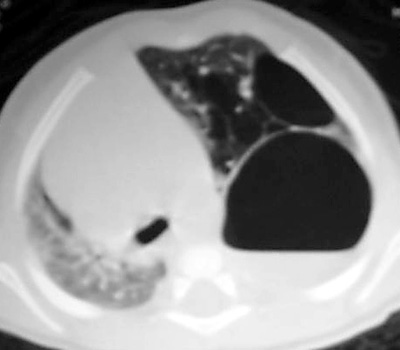 Pediatric Radiology